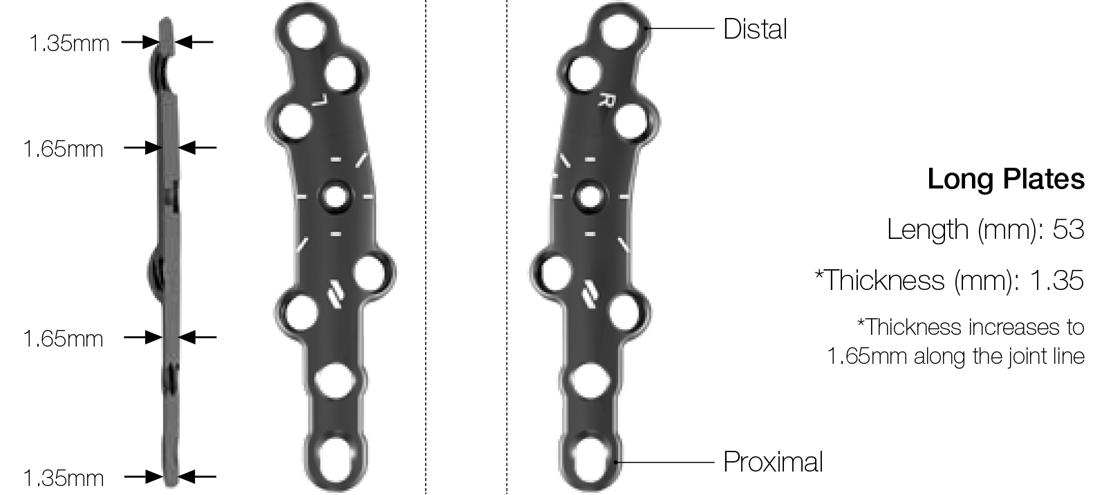 MTP Long / Revision Plates | Novastep Ortho